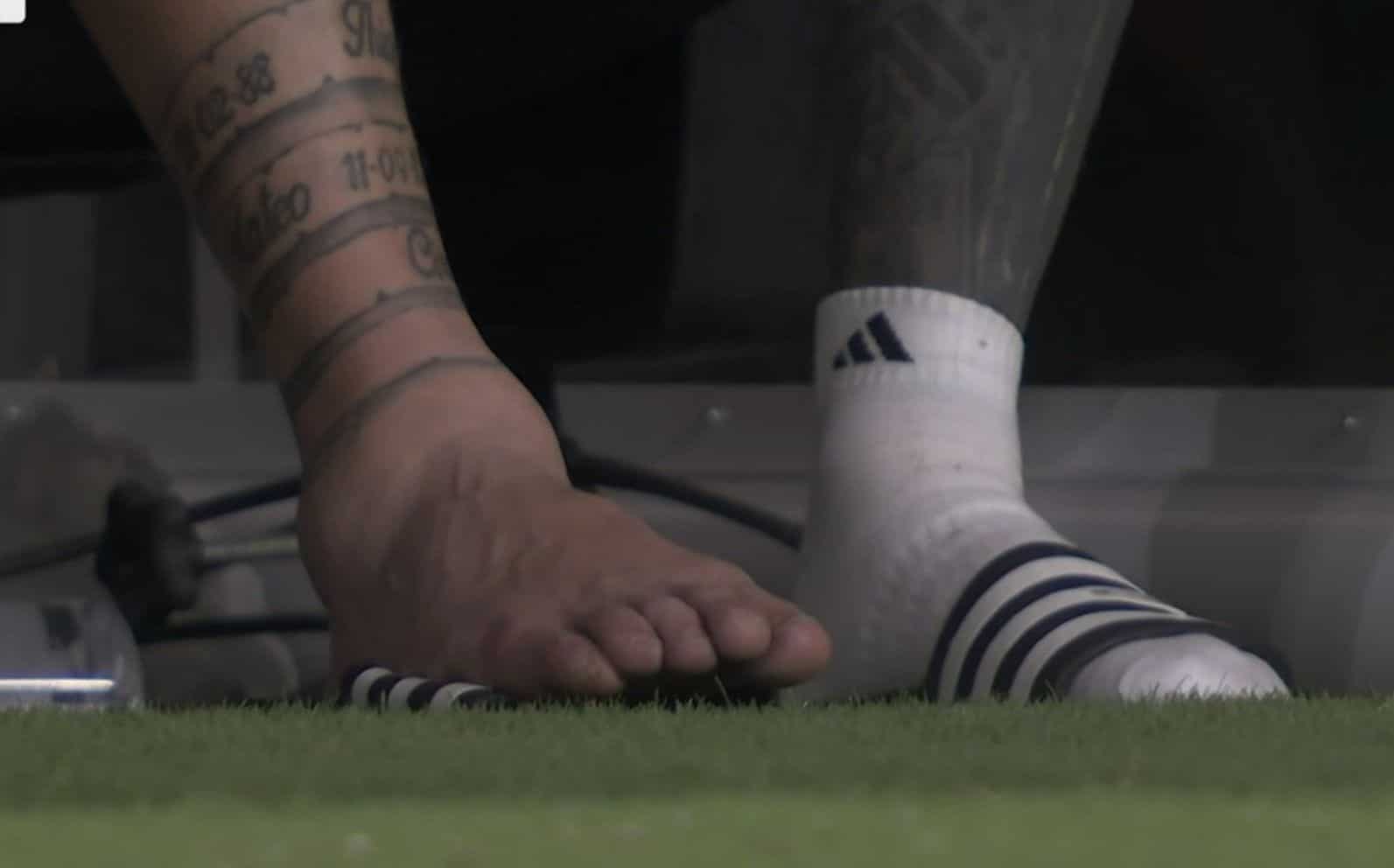 Así tiene el tobillo derecho Messi, luego de salir en la final | Diario ...
